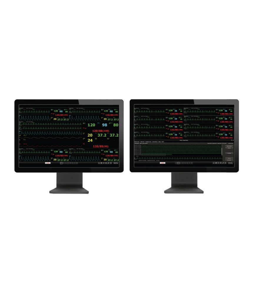 Patient Information Center iX (PIC iX) – Central Monitoring System ...