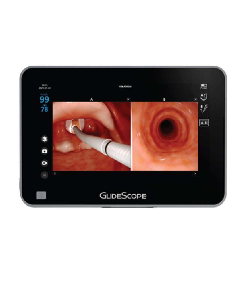 IntelliVue MP5SC – Spot Check Patient Monitor – Glomeda