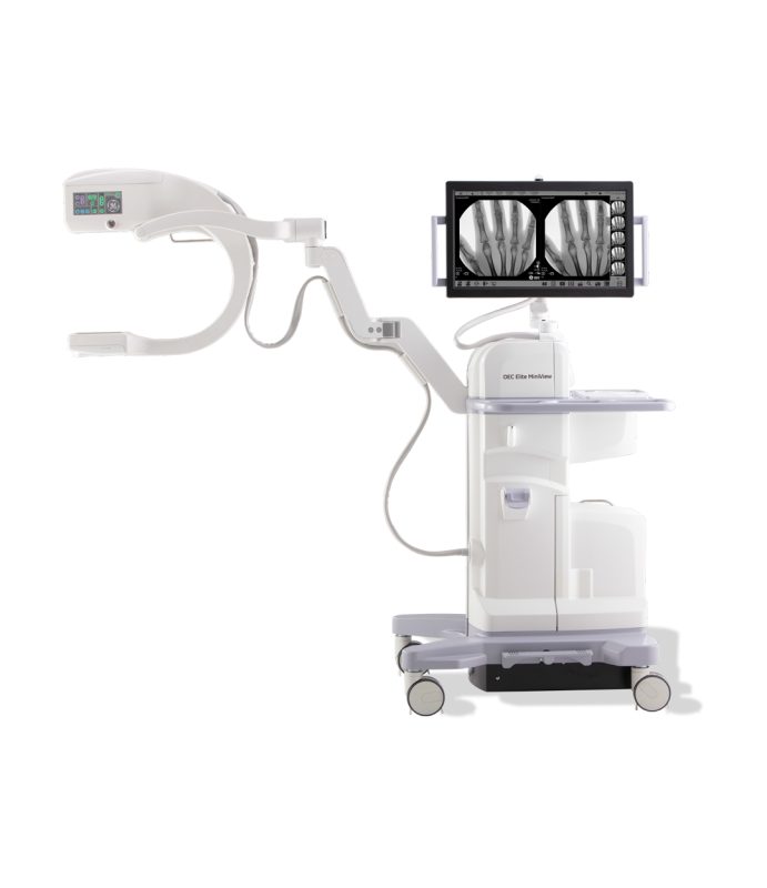 Revolution Maxima – CT Scan – Glomeda