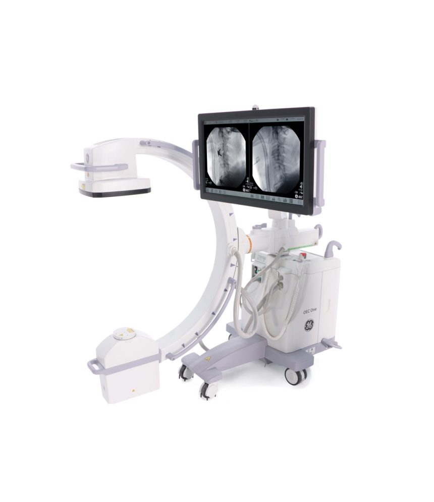 Revolution Frontier – CT Scan – Glomeda