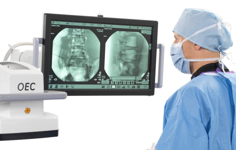 OEC One ASD – Mobile C-Arm – Glomeda